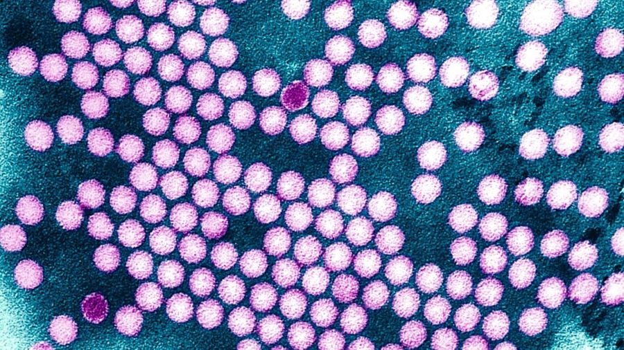 Día Mundial de la Polio; expertos advierten que si no